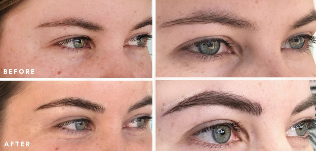 My Experience with Microblading Brows - Shenska
